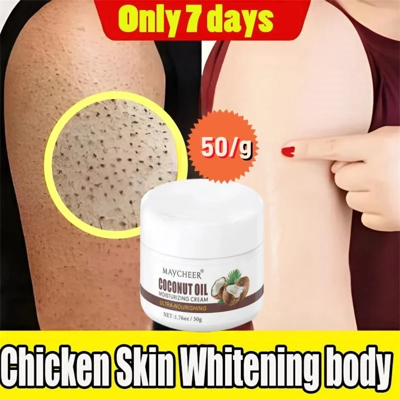 50g-Keratosis-Pilaris-Repair-Cream-Chicken-Follicle-Skin-Remove-Body ...