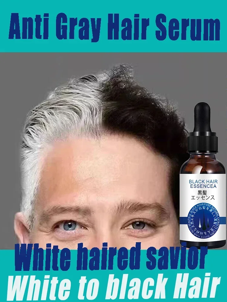 Anti-Gray-Hair-Essence-Blackening-Serum-Treatment-White-To-Black-Hair ...