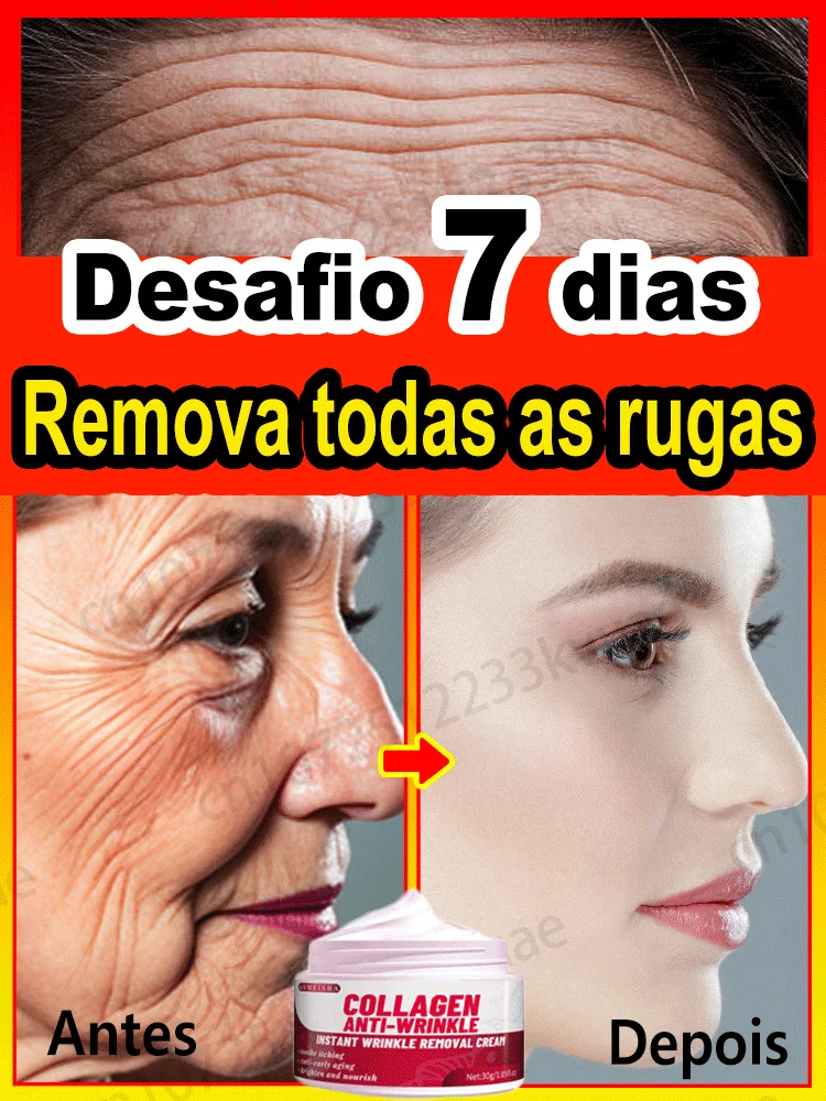 Anti-rugas-hidratante-creme-remove-rugas-linhas-do-pesco-o-dobras ...