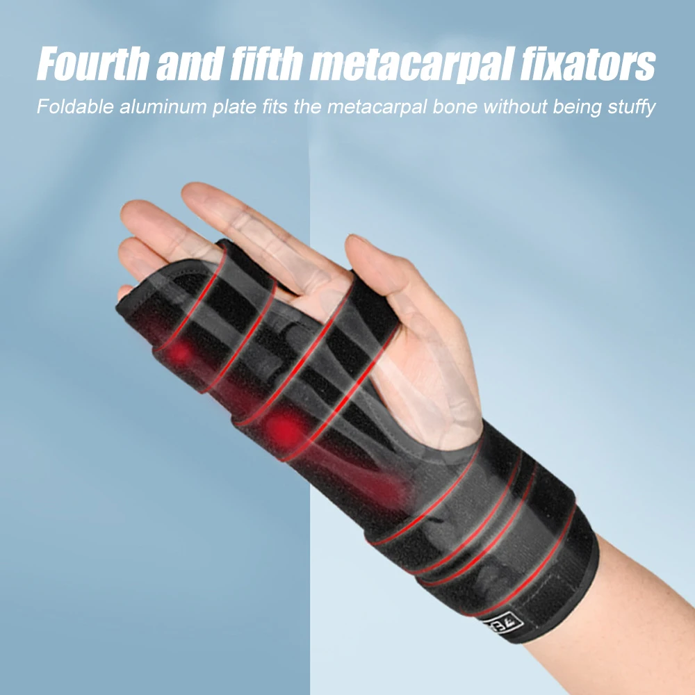 Ulnar Gutter Splint For 5th Metacarpal Fracture