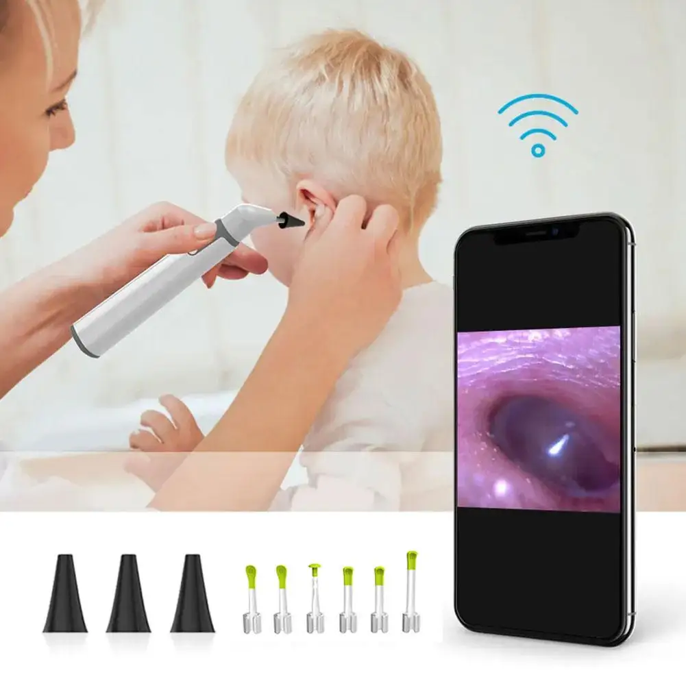 Ear-Camera-Endoscope-3-9mm-Wireless-Otoscope-720P-HD-WiFi-Ear-Scope ...