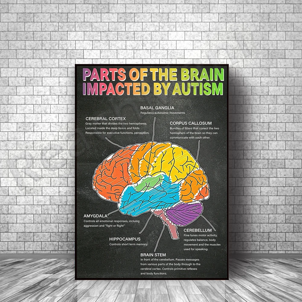 Brain Parts Poster