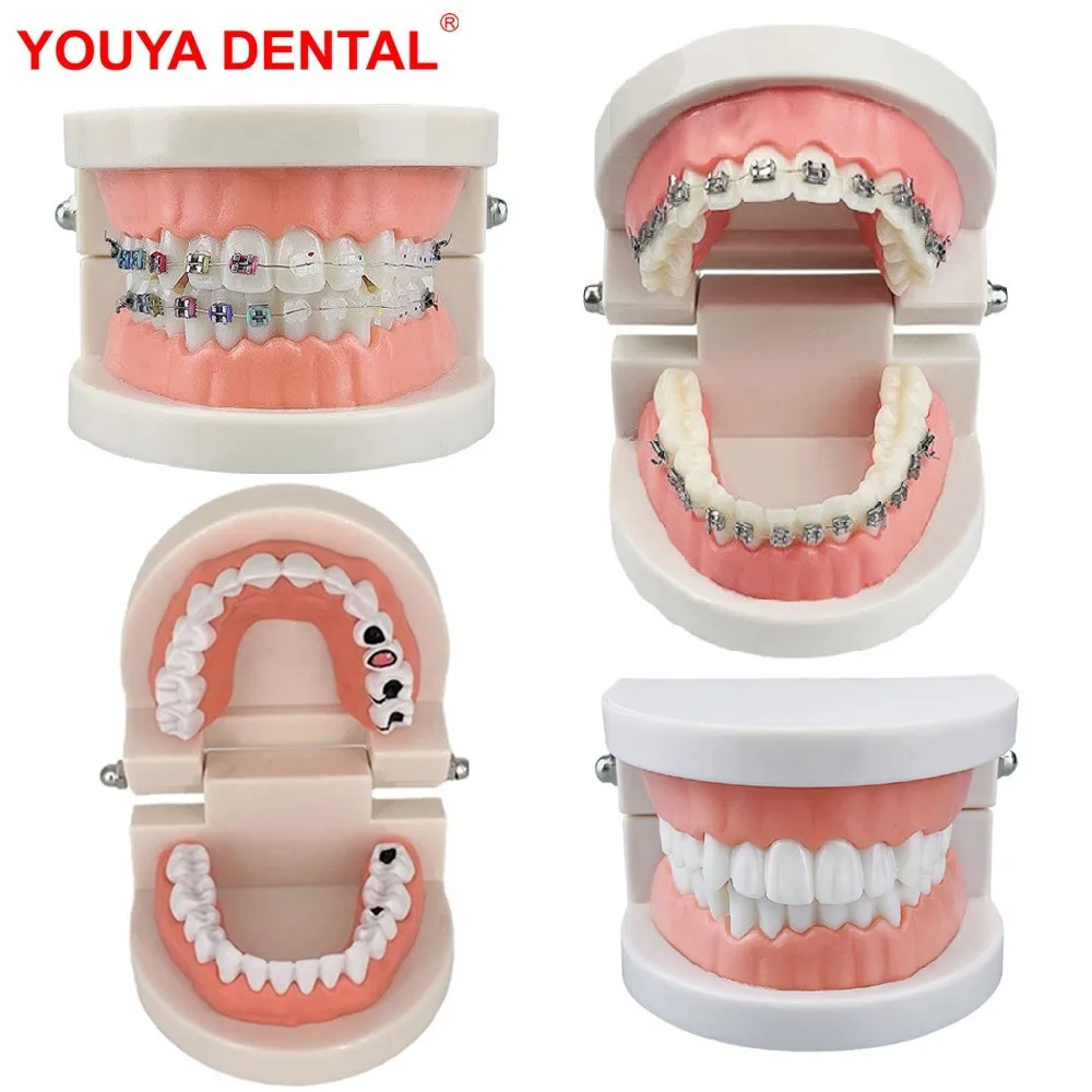 Dental-Teaching-Model-Standard-Dental-Orthodontic-Teeth-Model-With ...
