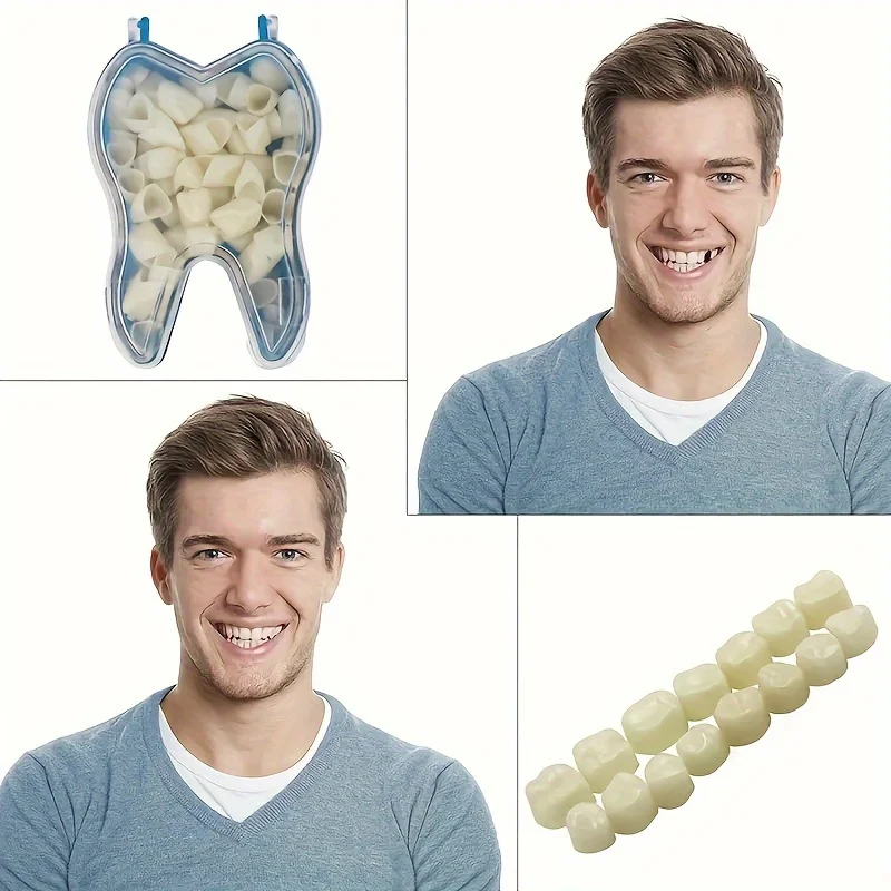 Daily-Life-Temporary-crown-Veneers-Teeth-Replacement-Veneers-Kit ...