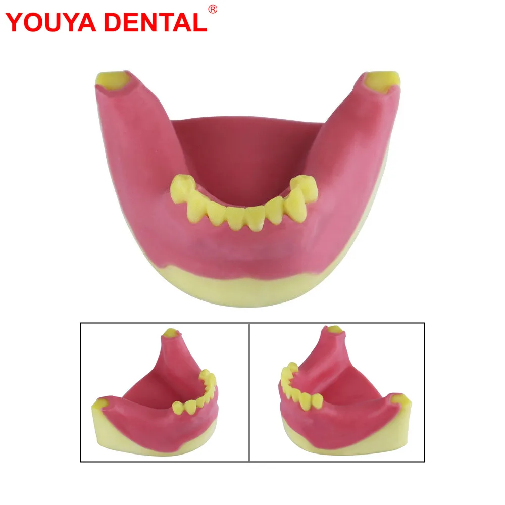 1pcs-Dental-Implant-Model-Bone-Defect-Supplementary-Training-Model ...
