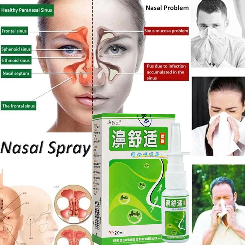Spray Nasal para la rinitis, tratamiento para la rinitis crónica ...