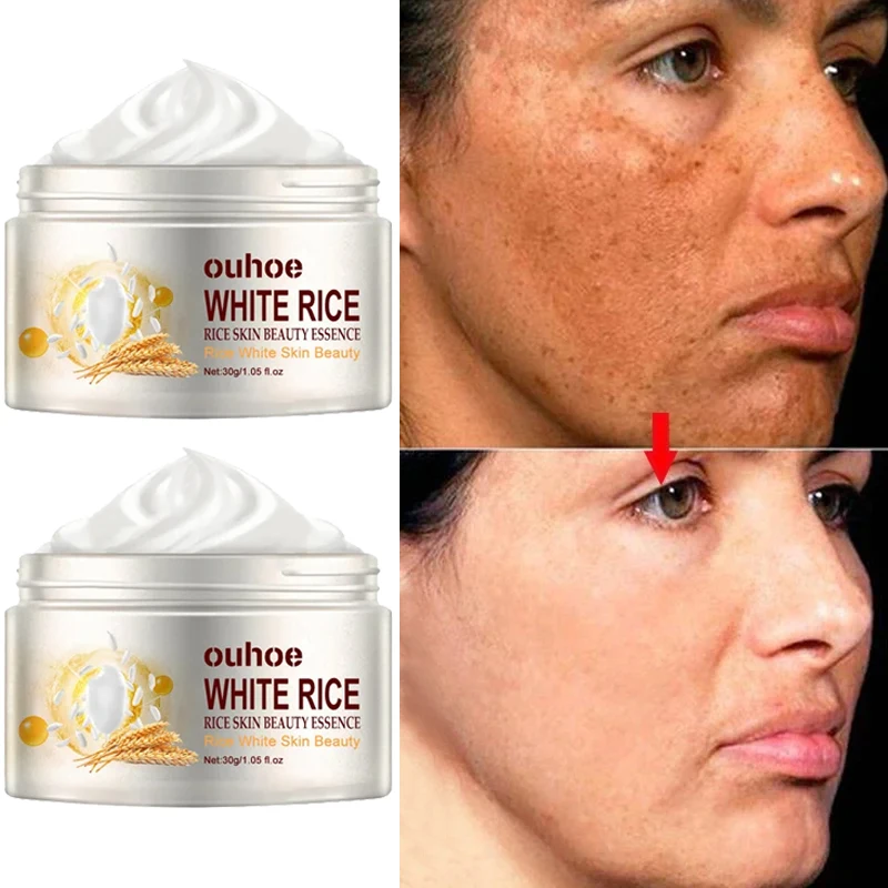 Crema-facial-blanqueadora-de-arroz-blanco-antiarrugas-l-neas-finas-elimina-manchas-oscuras ...