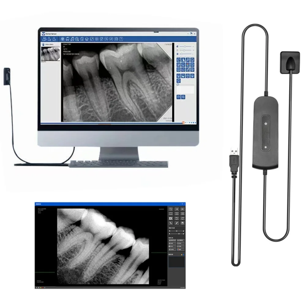 Dentistry-Dental-Digital-camera-Sensor-X-Ray-Dental-High-Frequency-Rx ...