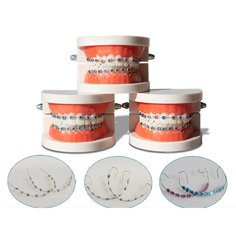 Fashion Braces 1 Pair Colorful Temporary Tooth Decoration With Metal ...