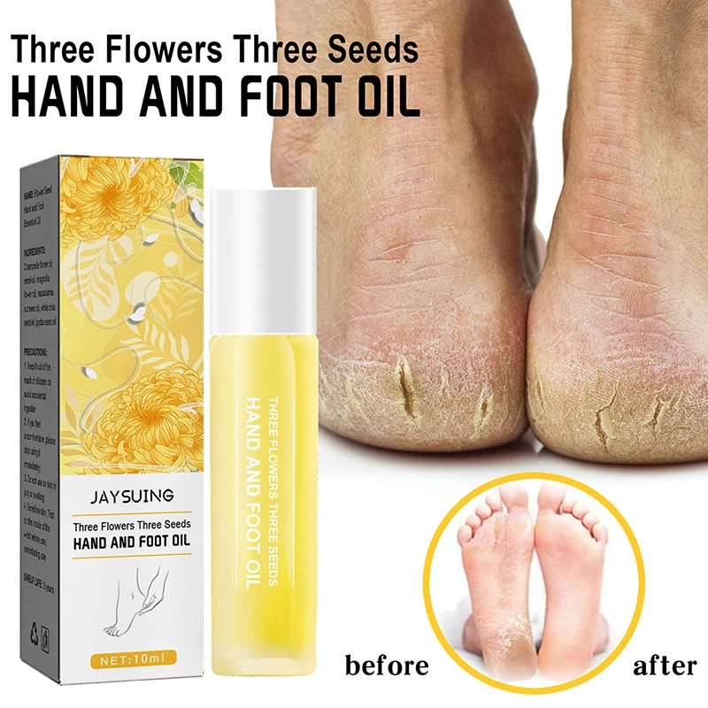 10ml Anti Crack Foot Oil Dead Skin Remover Essence Heel Moisturizing ...