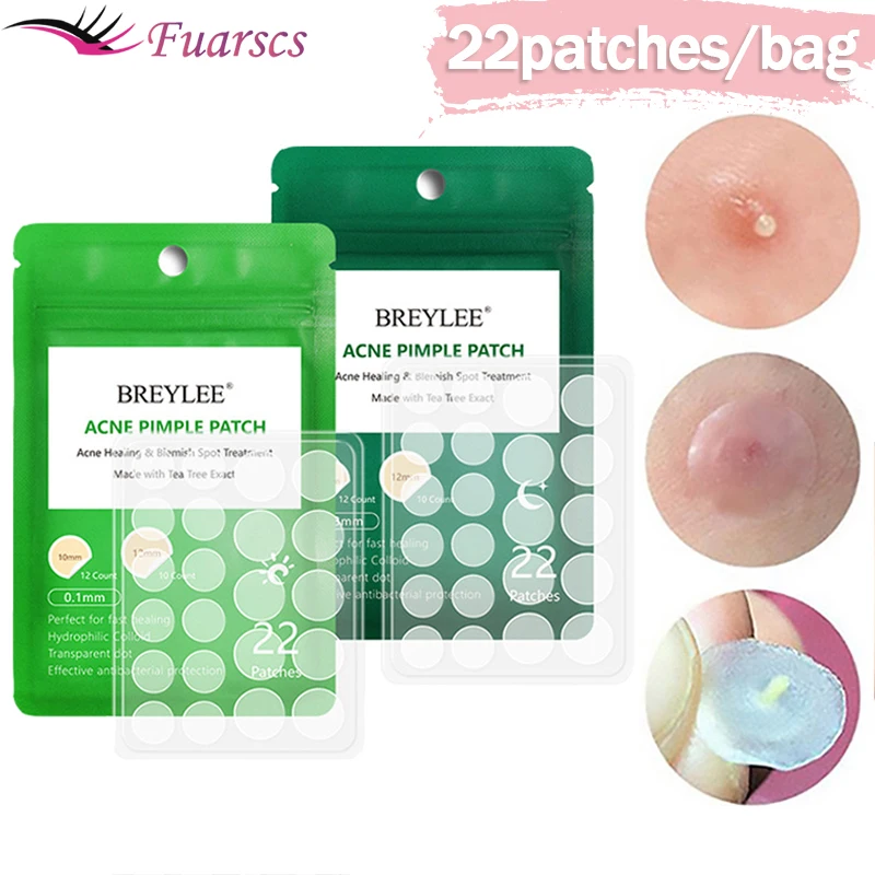 0-1mm-Acne-Pimple-Patch-Stickers-Waterproof-Acne-Treatment-Pimple ...