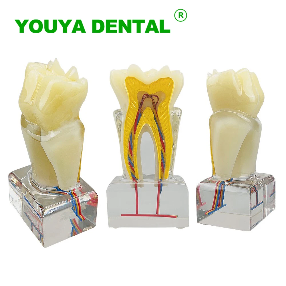 Dental-Demonstration-Model-Teeth-Anatomy-Model-With-Nerve-Vessels ...