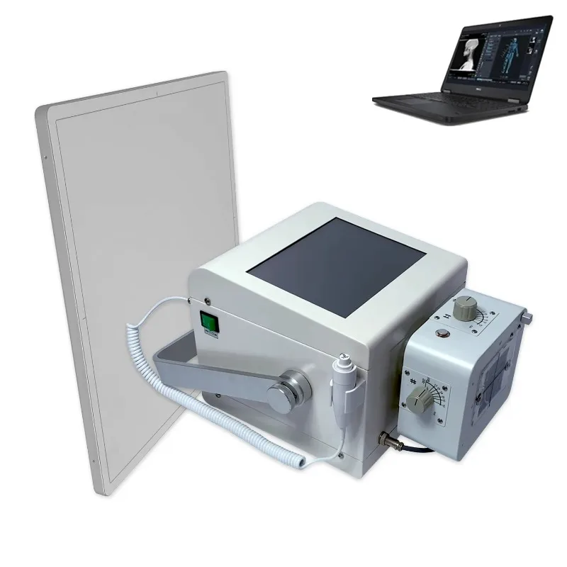 Medical-5KW-portable-digital-x-ray-machine-xray-price-for-Factory ...