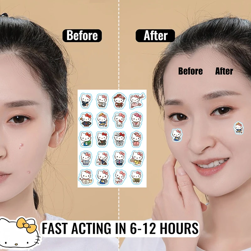 100pc-Hello-Kitty-Cat-Repair-Acne-Patch-Facial-Skin-Care-Fade-Blemishes ...