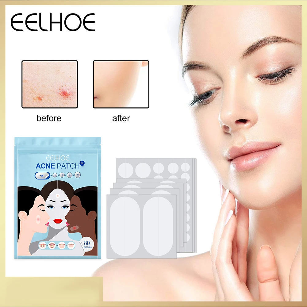 80pcs 8/10/12mm Acne Patches Pimple Healing Treatment Invisible Spot ...