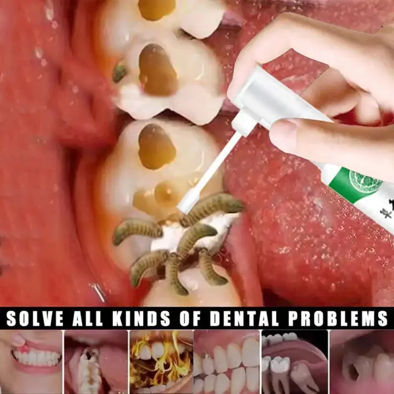 Tooth-Pain-Relief-Treatment-Spray-Toothache-Cure-Teeth-Decay-Remover ...