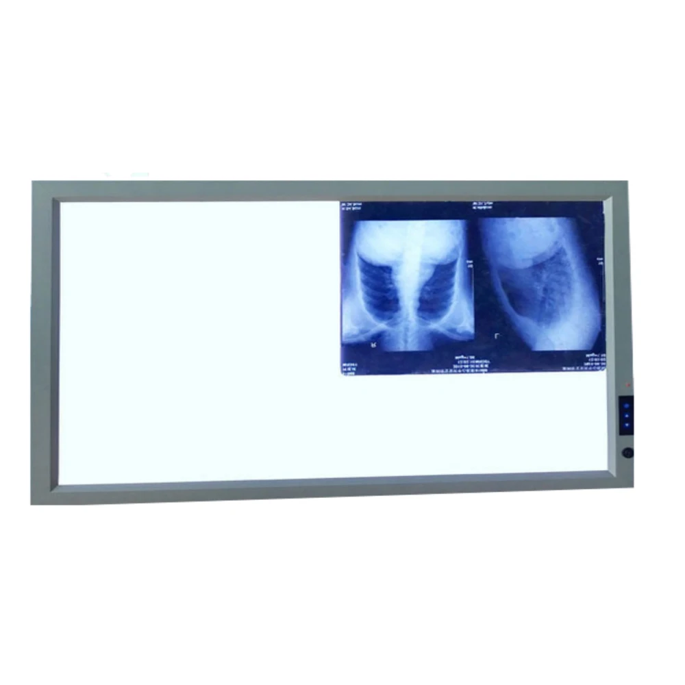 2025 Negatoscope Price X Ray Film Medical Union Led Professional Film ...