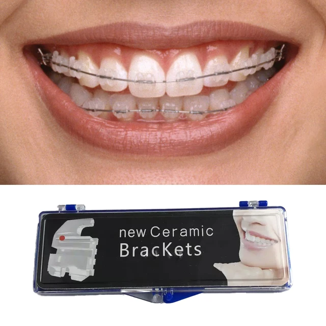 Brackets De Ortodoncia This Is Looking So Good!!! Great Work