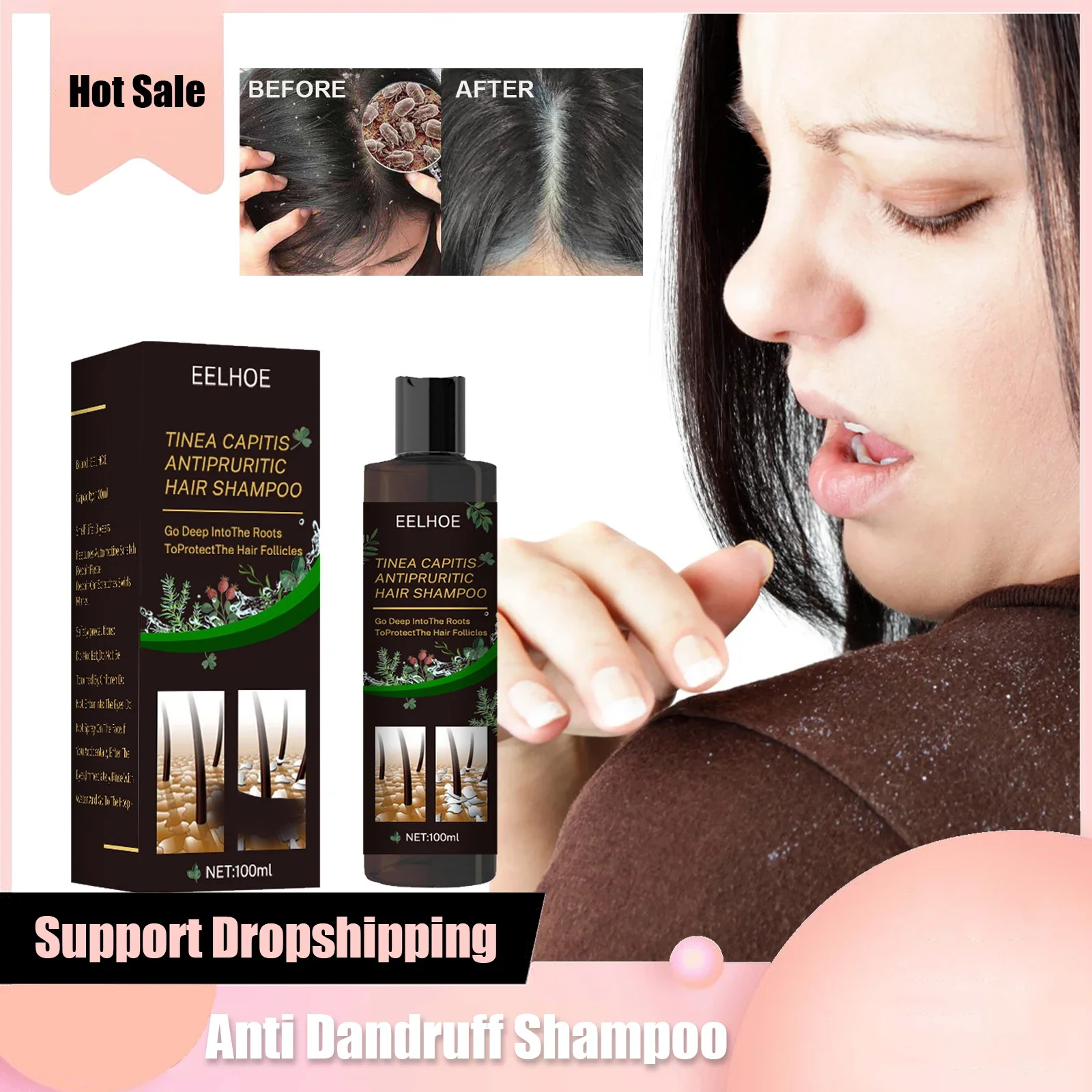 Shampoo-Anti-Caspa-para-o-Cuidado-do-Cabelo-Tinea-Capitis-Shampoo ...