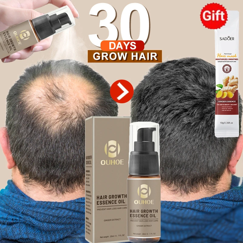 Leistungsstarke Haar Wachstum Serum Spray Ingwer Anti Haarausfall ...