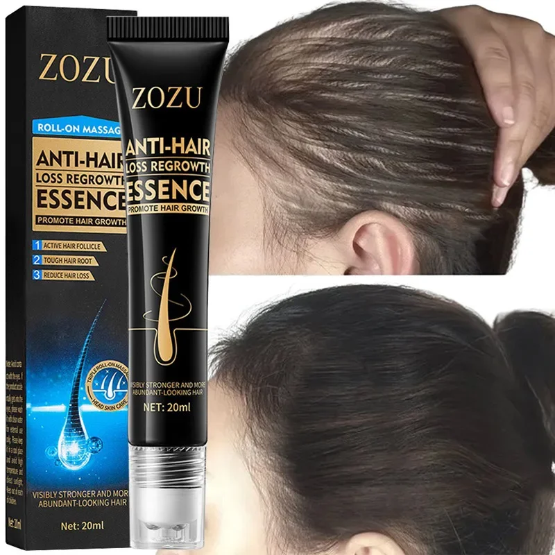 Anti-Hair-Loss-Fast-Hair-Growth-Essence-Strengthens-Hair-Roots-Repair ...