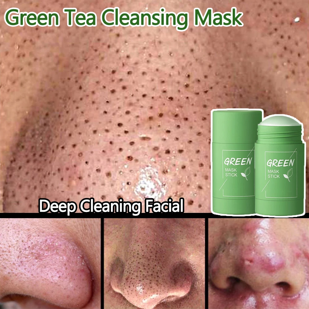Green-Tea-Solid-Cleansing-Mask-Dispel-Acne-Blemish-Mark-Remove ...