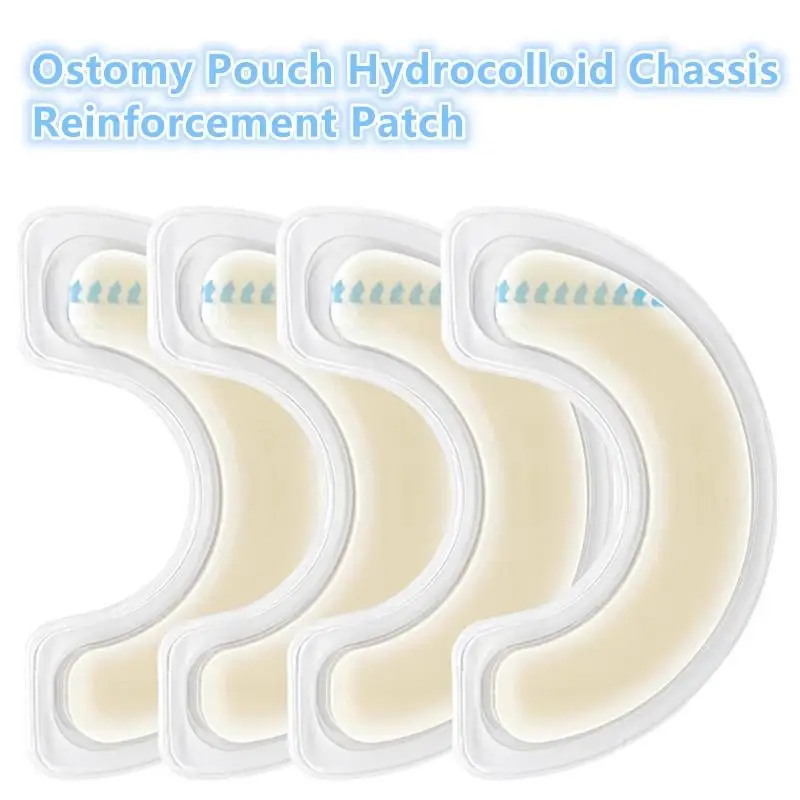 1/4 Pcs Elastic Ostomy Barrier Strips Hydrocolloid Waterproof Leak Skin ...