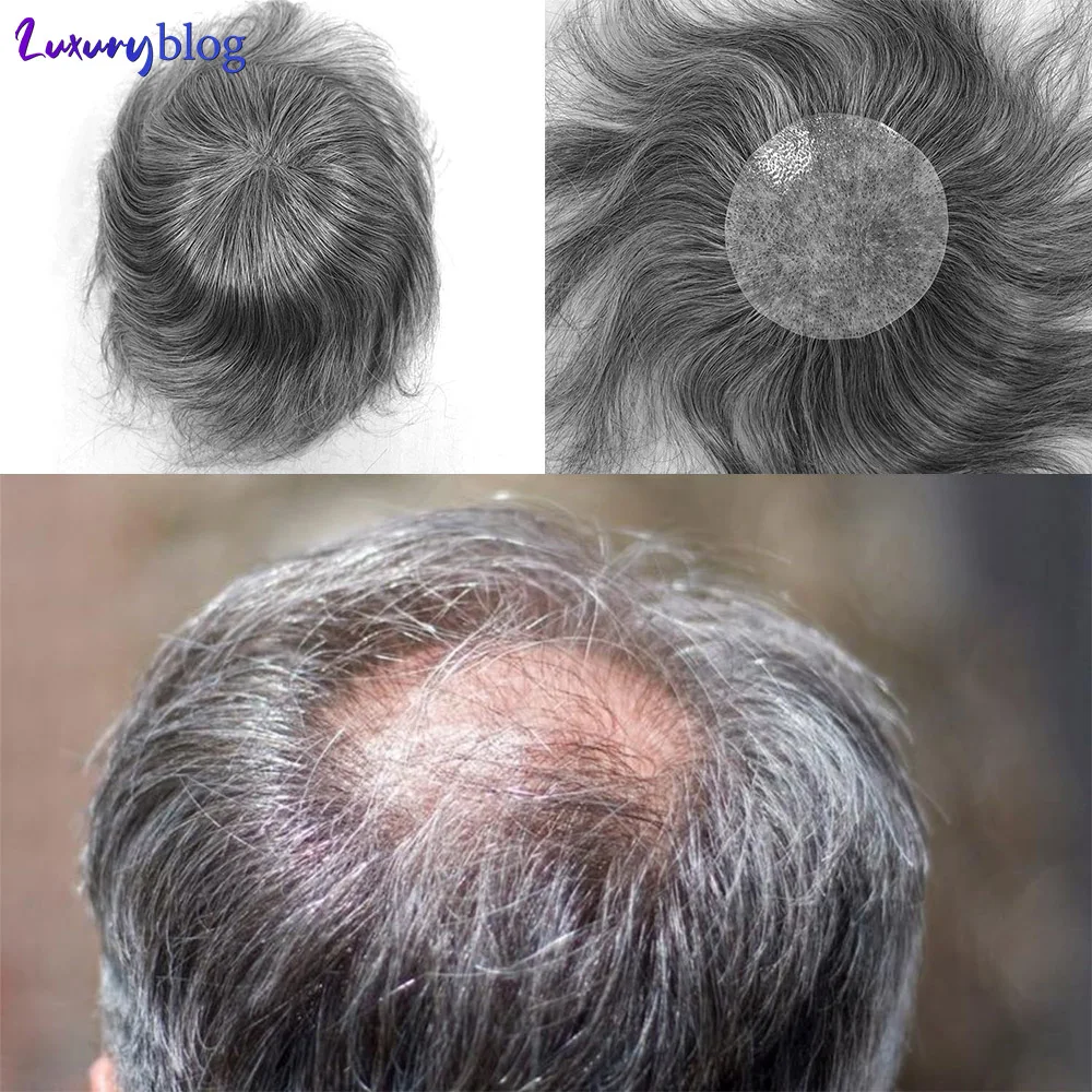 What Is a Bold Spot Hair Patch and Why Is the Grey Thin Skin PU V ...