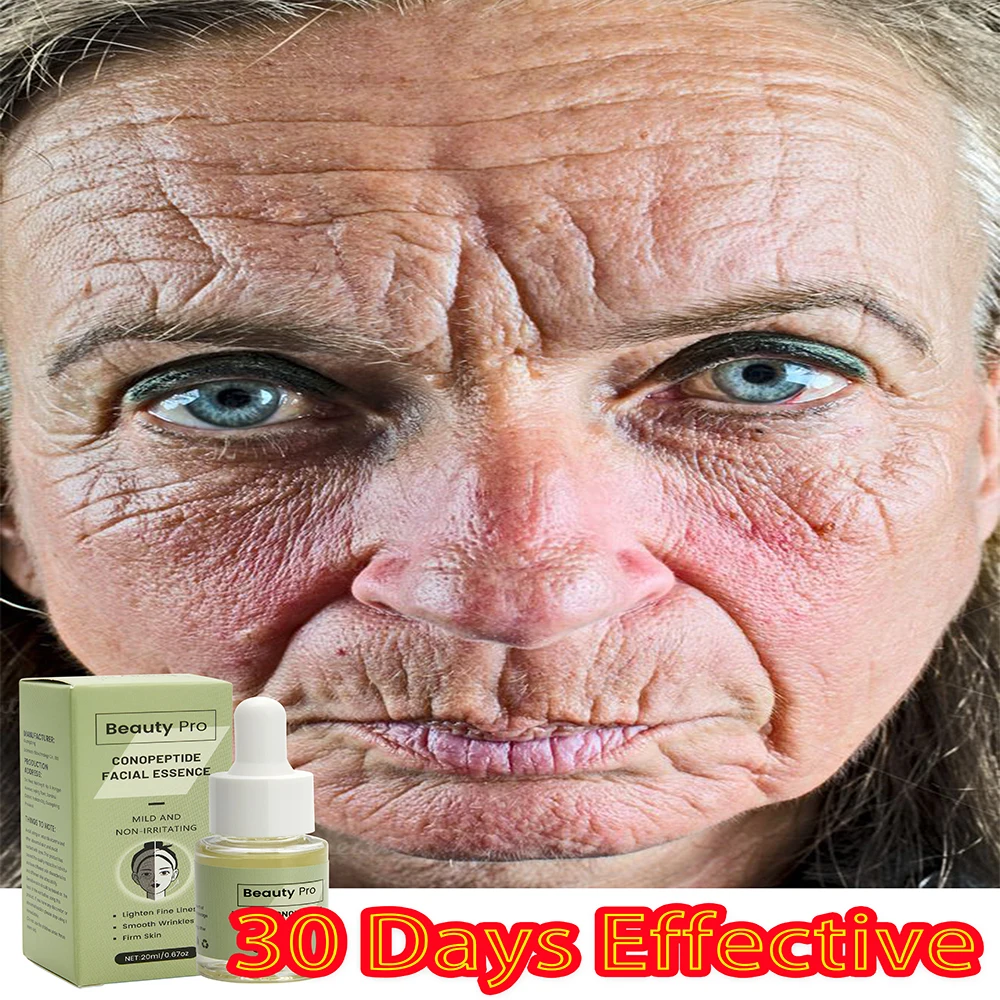 Serum-For-Face-Hyaluronic-Acid-Lighten-Age-Black-Spots-Sunburn-Anti ...