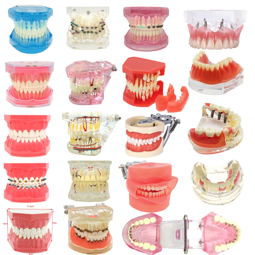 Dental-Model-Teeth-Dental-Teaching-Models-Implant-Model-Study ...