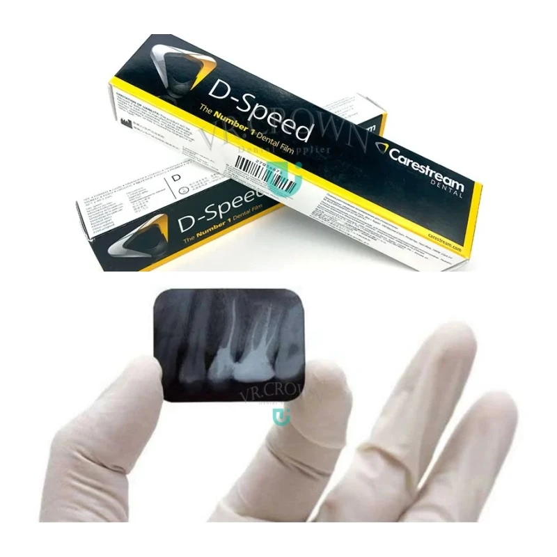 D-Speed-X-Ray-Dental-Films-CareStream-D-Speed-Intraoral-X-Ray-Film ...