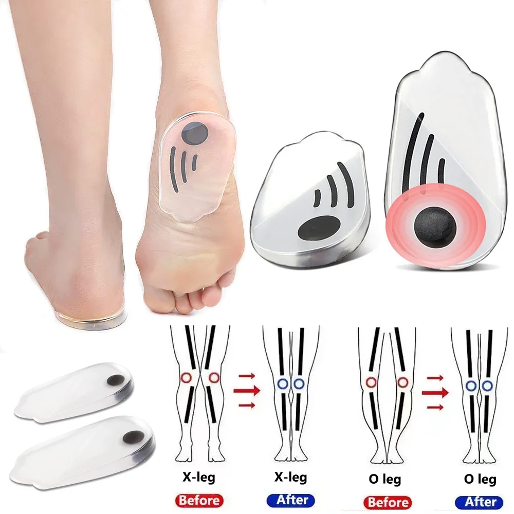 Silicone Orthopedic Insoles for Shoes Men Women Plantar Fasciitis ...