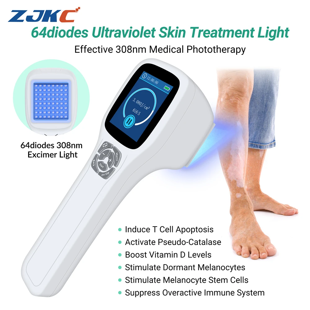 ZJKC-308nm-UVB-Light-Therapy-Phototherapy-Device-Facial-and-Body-Blue-Light-Therapy-for-Vitiligo ...