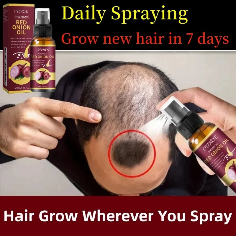 New-Powerful-Hair-Growth-Serum-Spray-Repair-Hair-Nourish-Root-Regrowth ...