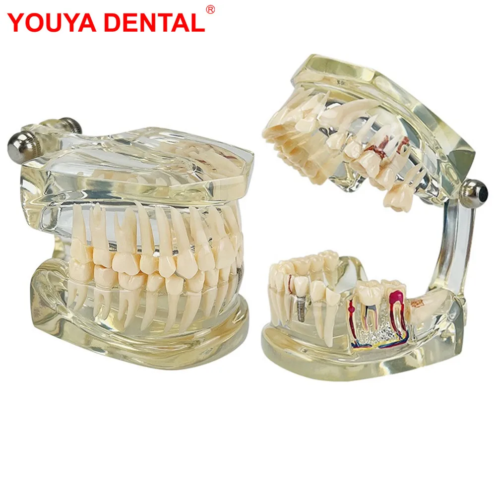 Dental-Teeth-Model-Teaching-Study-Anatomical-Teeth-Model-Transparent ...