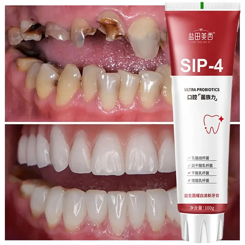Probiotic-Toothpaste-Sp-4-Whitening-Tooth-Remove-Bad-Breath-Plaque ...