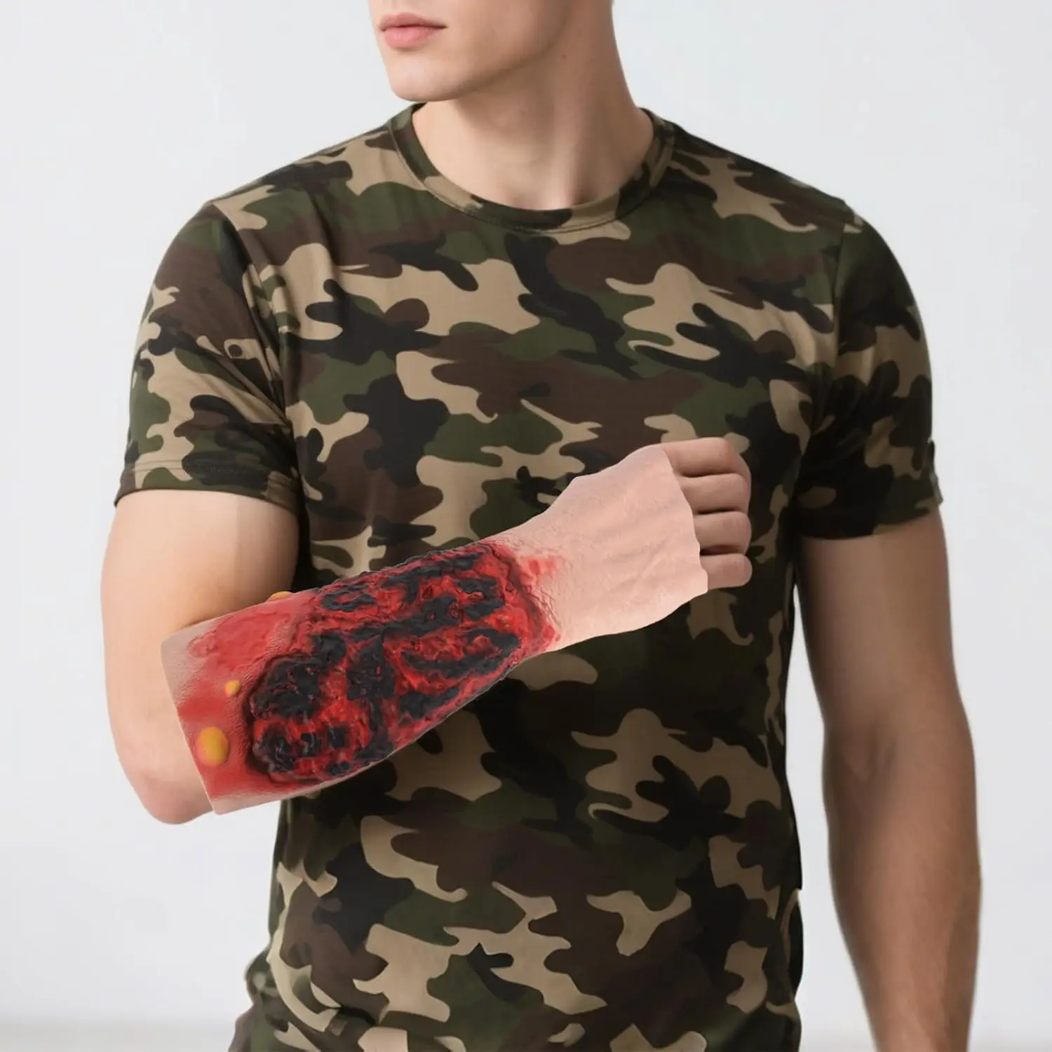 3rd Degree Forearm Burn Simulation Sleeve Burn Wound Packing Trainer ...