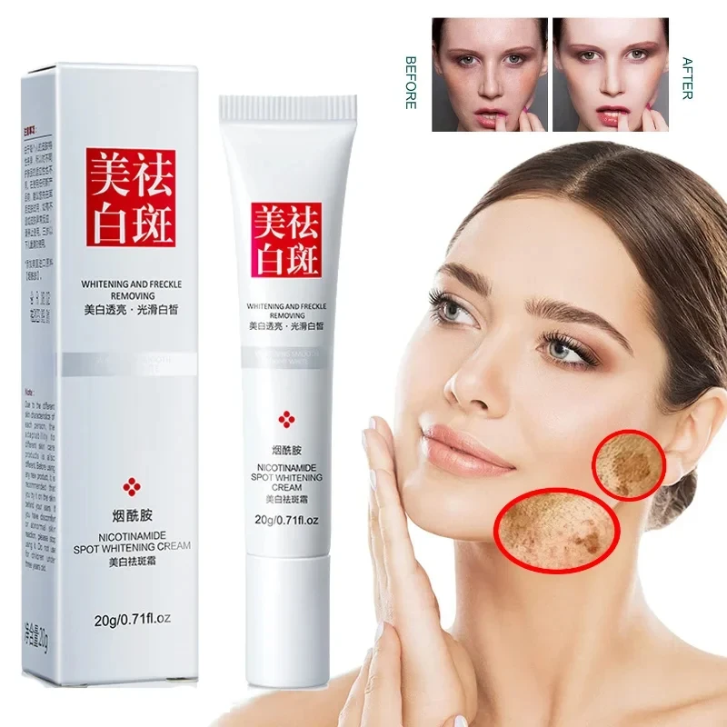 Fades-Freckle-Dark-Spots-Face-Cream-Niacinamide-Whitening-Cream-Vitamin ...