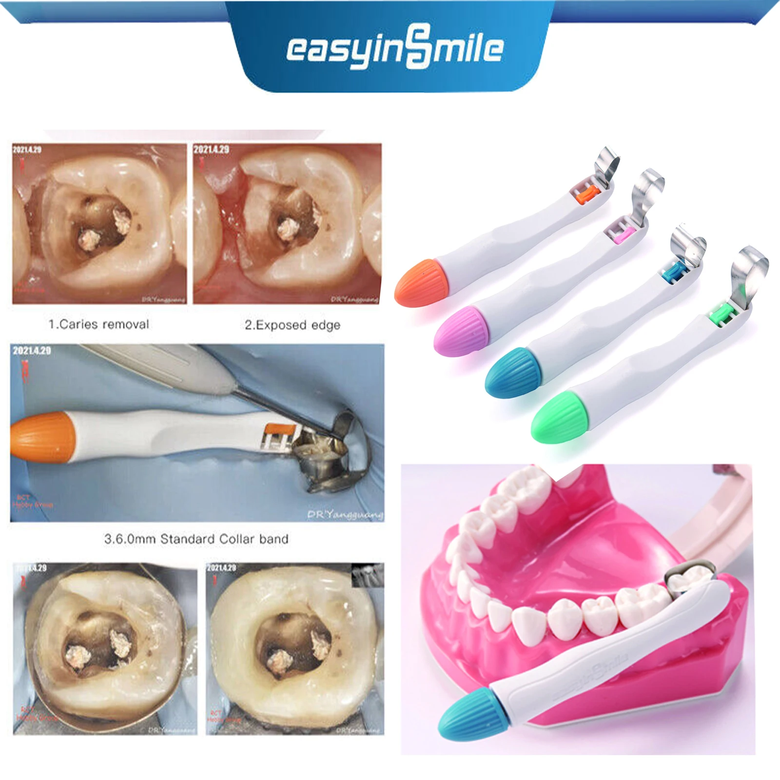 50pcs-Dental-Pro-Matrix-Bands-Easyinsmile-Preformed-Adjustable-Ring ...