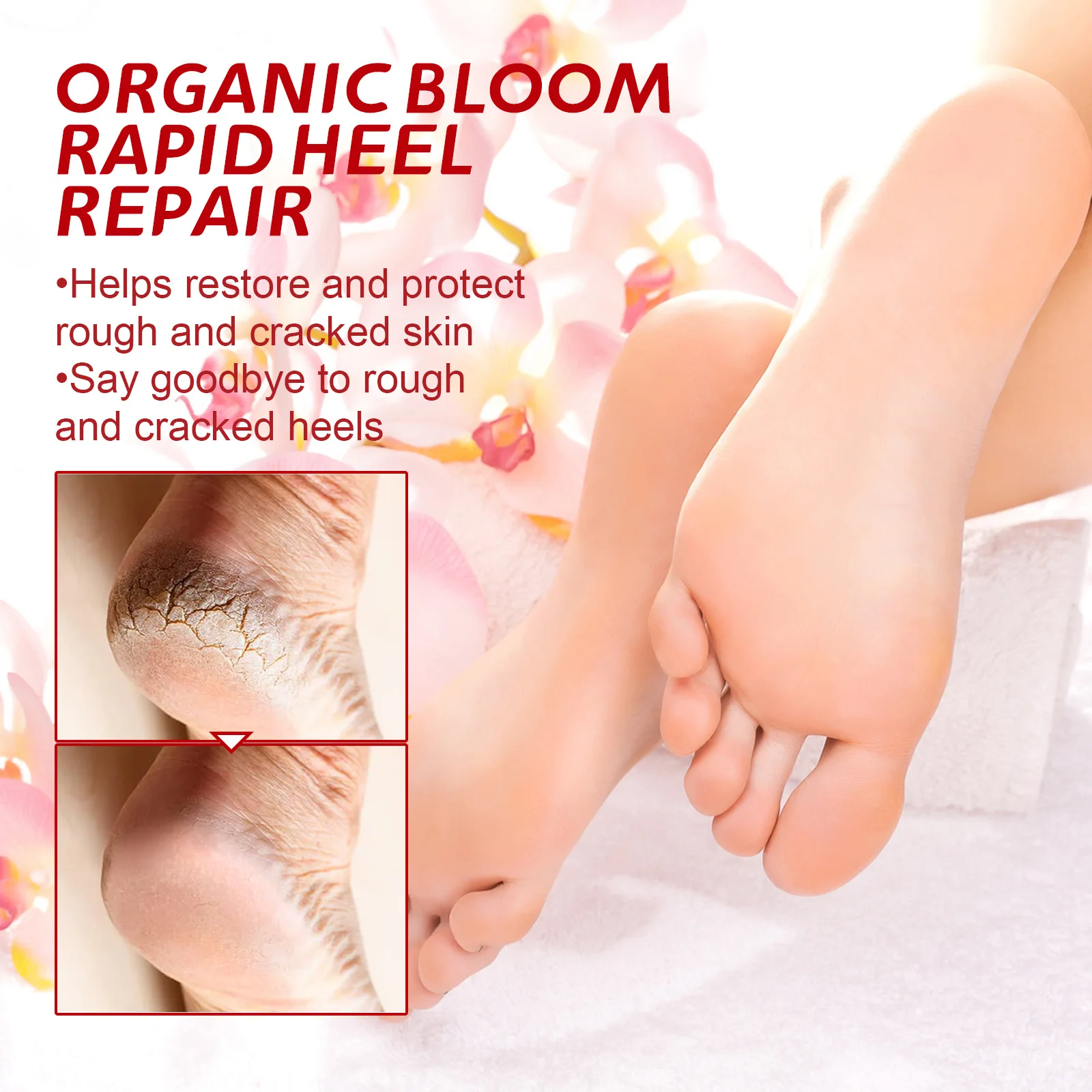 Heel Clappers Exercise