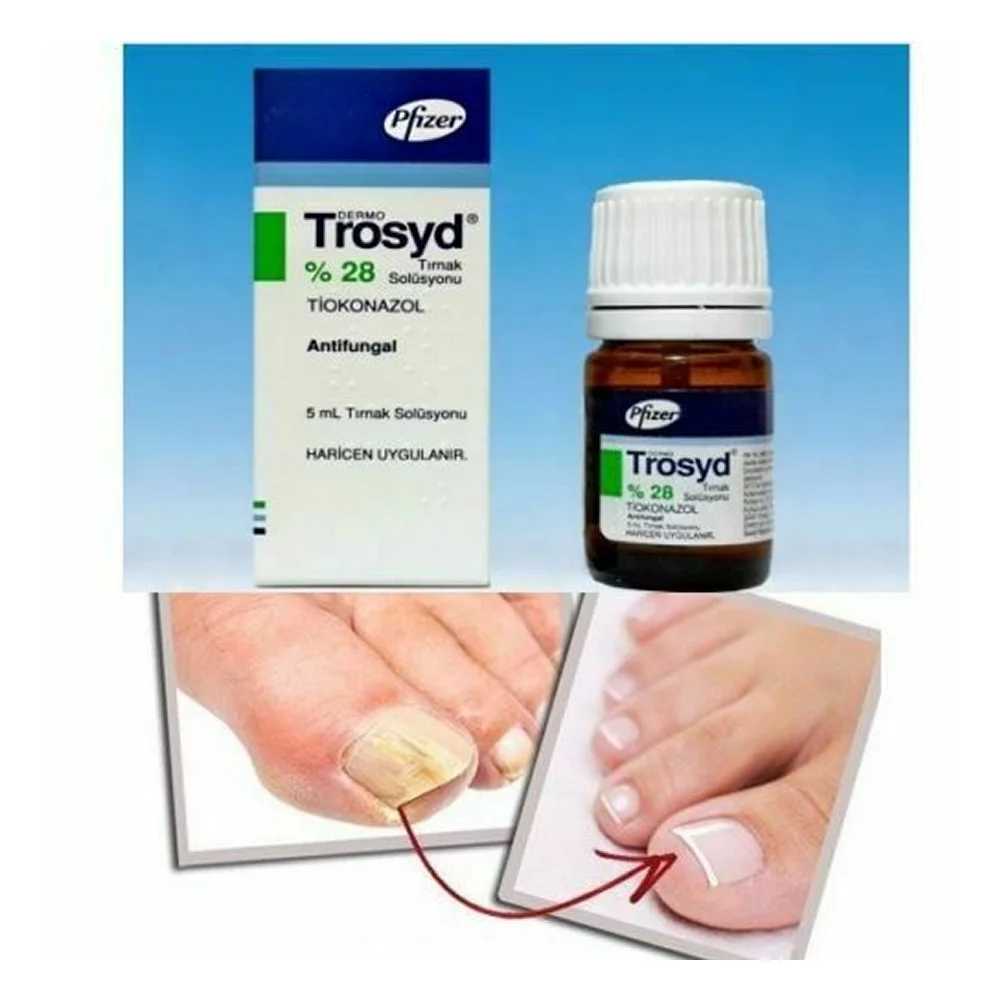 Pfizer Dermo Trosyd 5 Ml % 28 Tioconazoleเชื้อราเล็บTreatment Trosyl ...