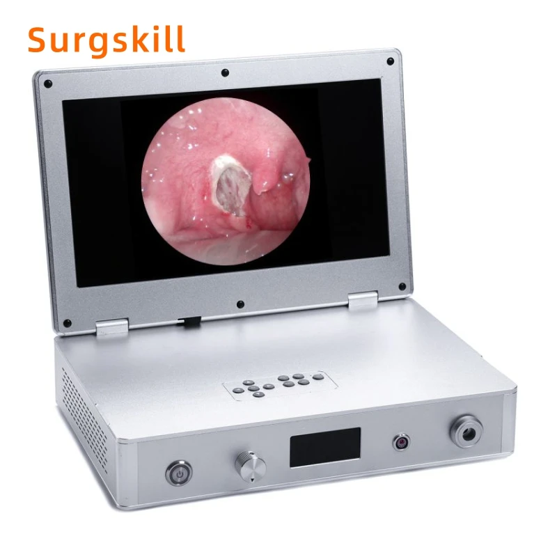 Full-HD-1080P-Integrated-Endoscope-Camera-System-with-40W-Light-Source ...